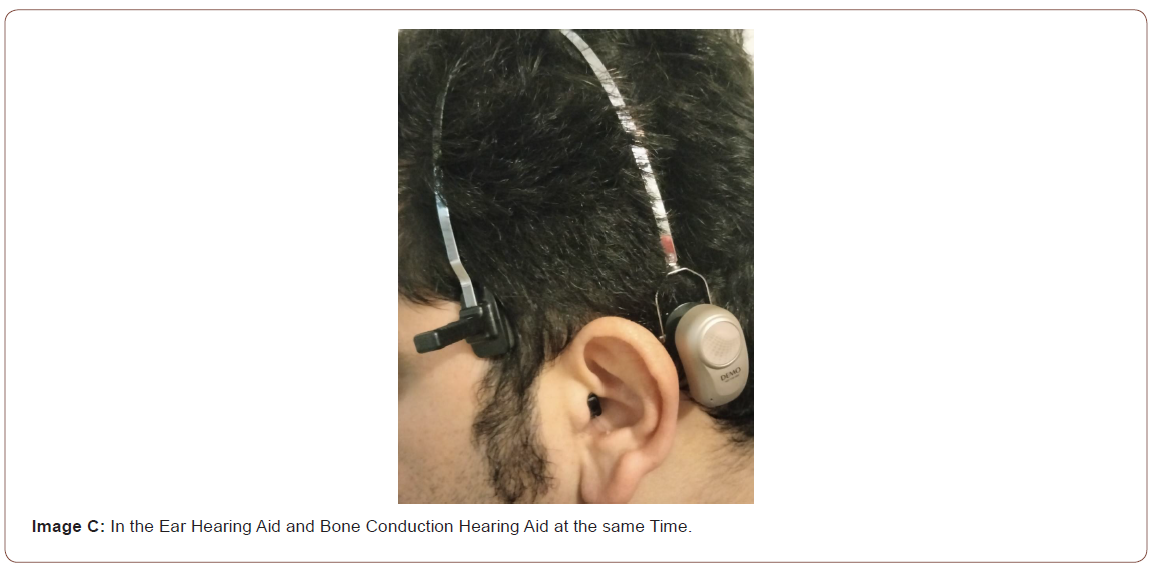 Vibration- Acoustic Stimulation a New Approach for the Treatment of ...
